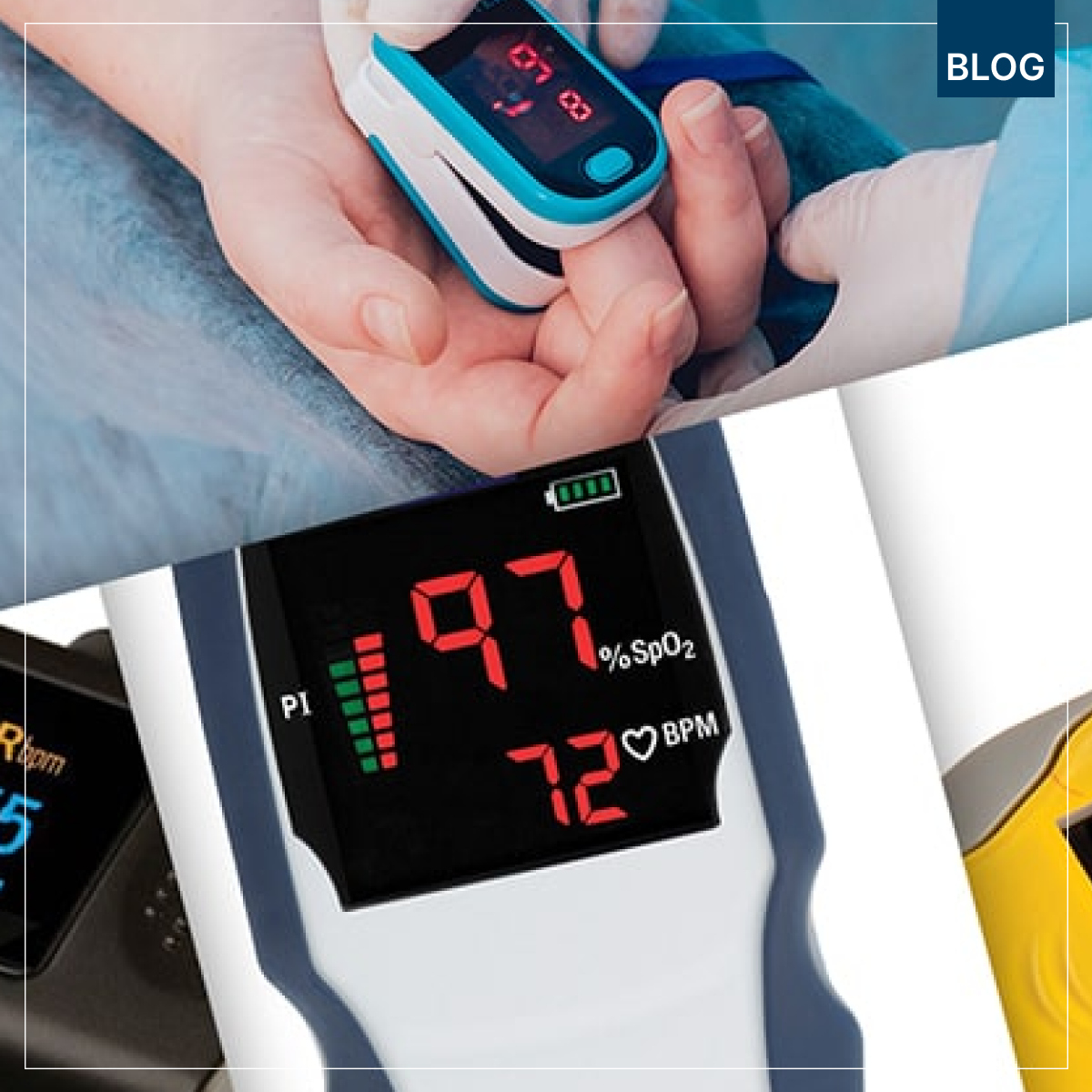 Pulse Oximeters - What are they and how do they work? – MedTree