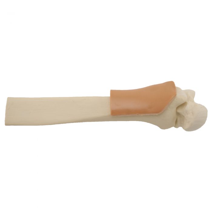 EZ-IO Training Bone (Adult Distal Tibia - with Skin Patch) – MedTree
